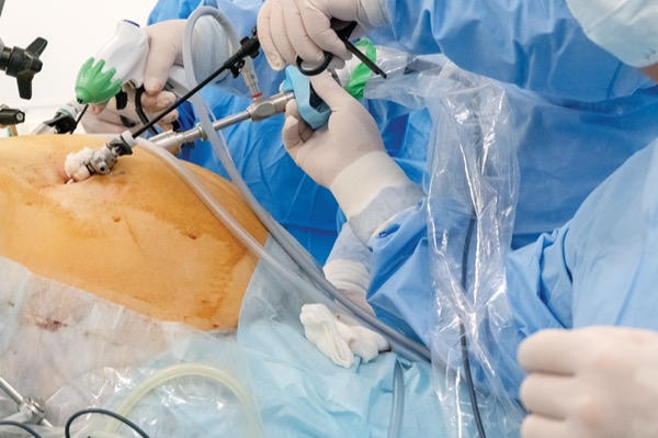 Bariatric Vitamins Opurity